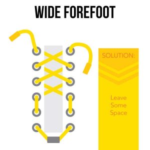 Lacing Technique - East Coast Podiatry Clinic
